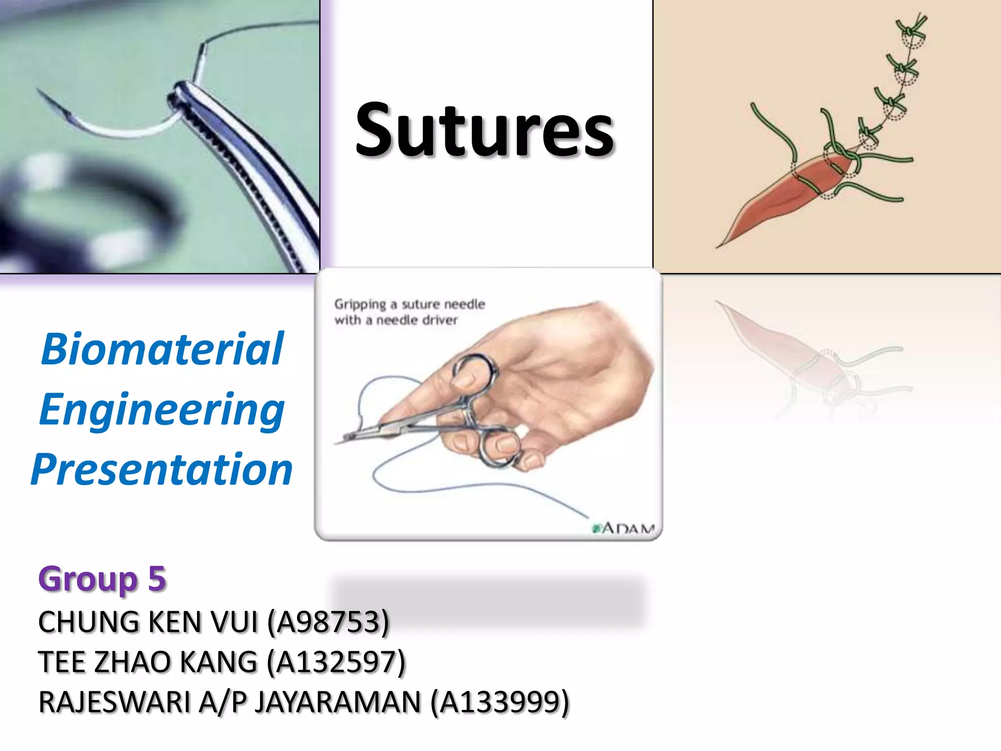 Sutures | PPTX