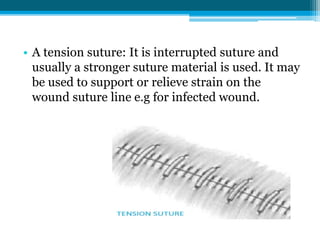Sutures | PPTX