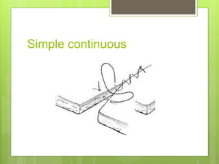 Sutures | PPTX