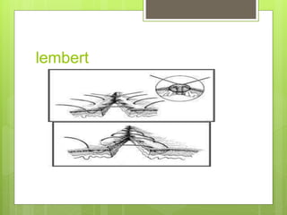 Sutures | PPTX