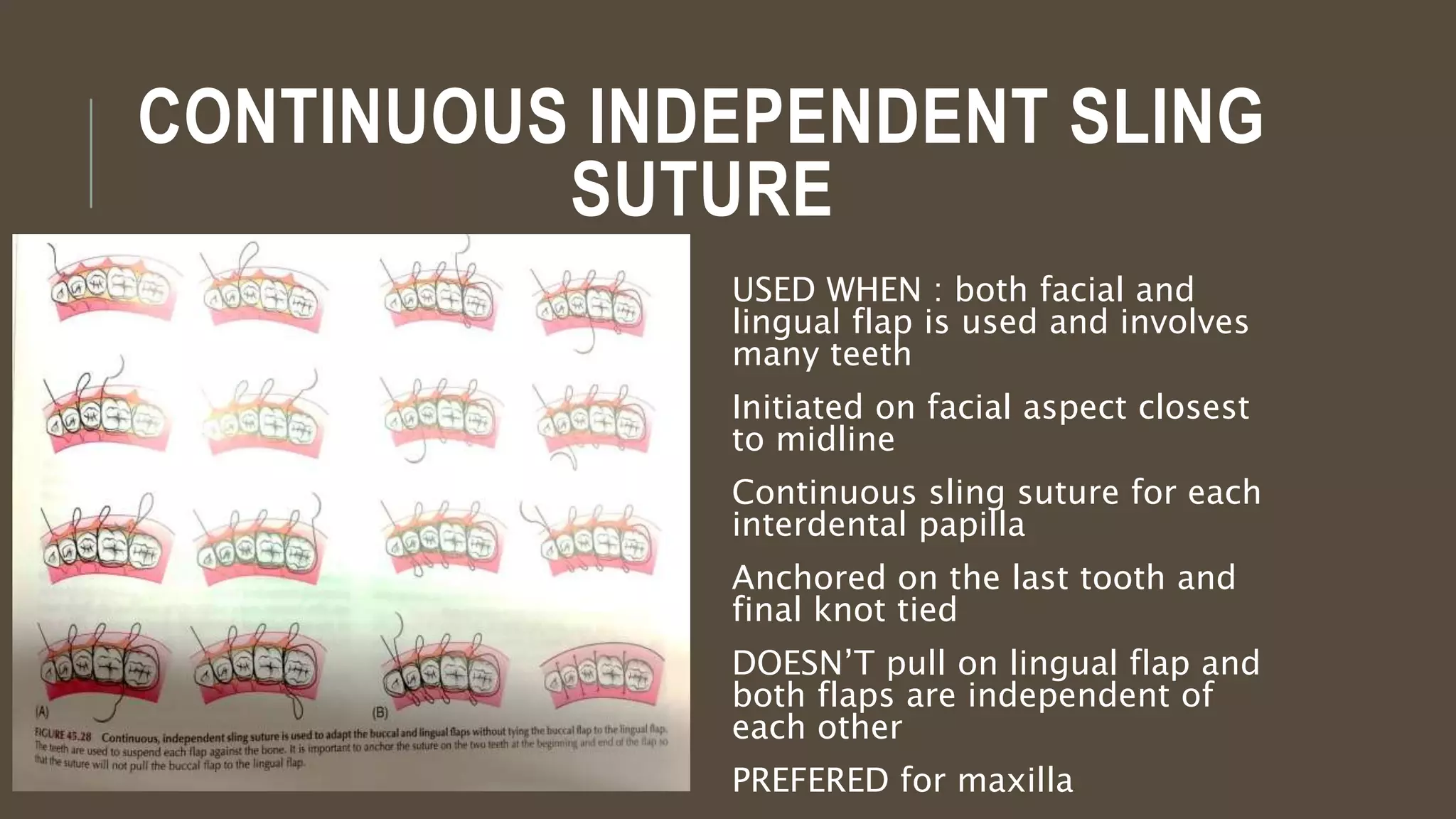 Periodontal Sutures | PPTX