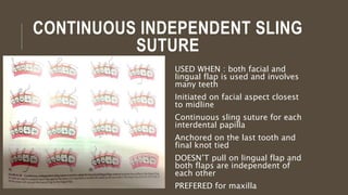Periodontal Sutures | PPTX