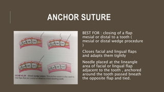Periodontal Sutures | PPTX