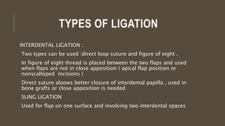 Periodontal Sutures | PPTX