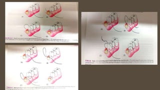 Periodontal Sutures | PPTX