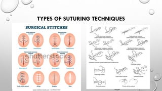 SUTURES PRESENTATION IN SURGERY REVISED.pdf
