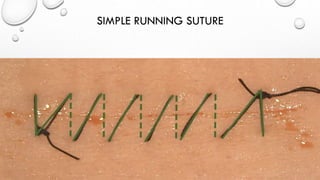 SUTURES PRESENTATION IN SURGERY REVISED.pdf