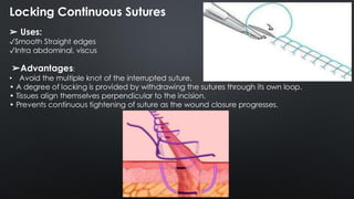 sutures and instruments handling seminar | PDF