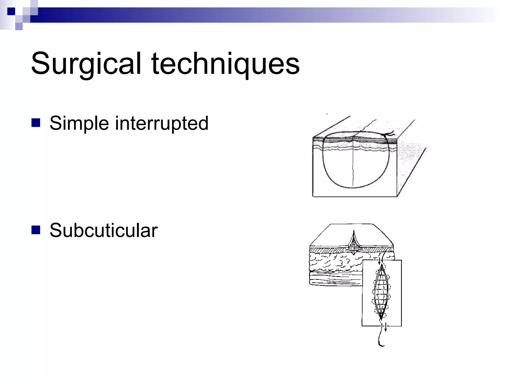 Sutures & Drainage | PPT