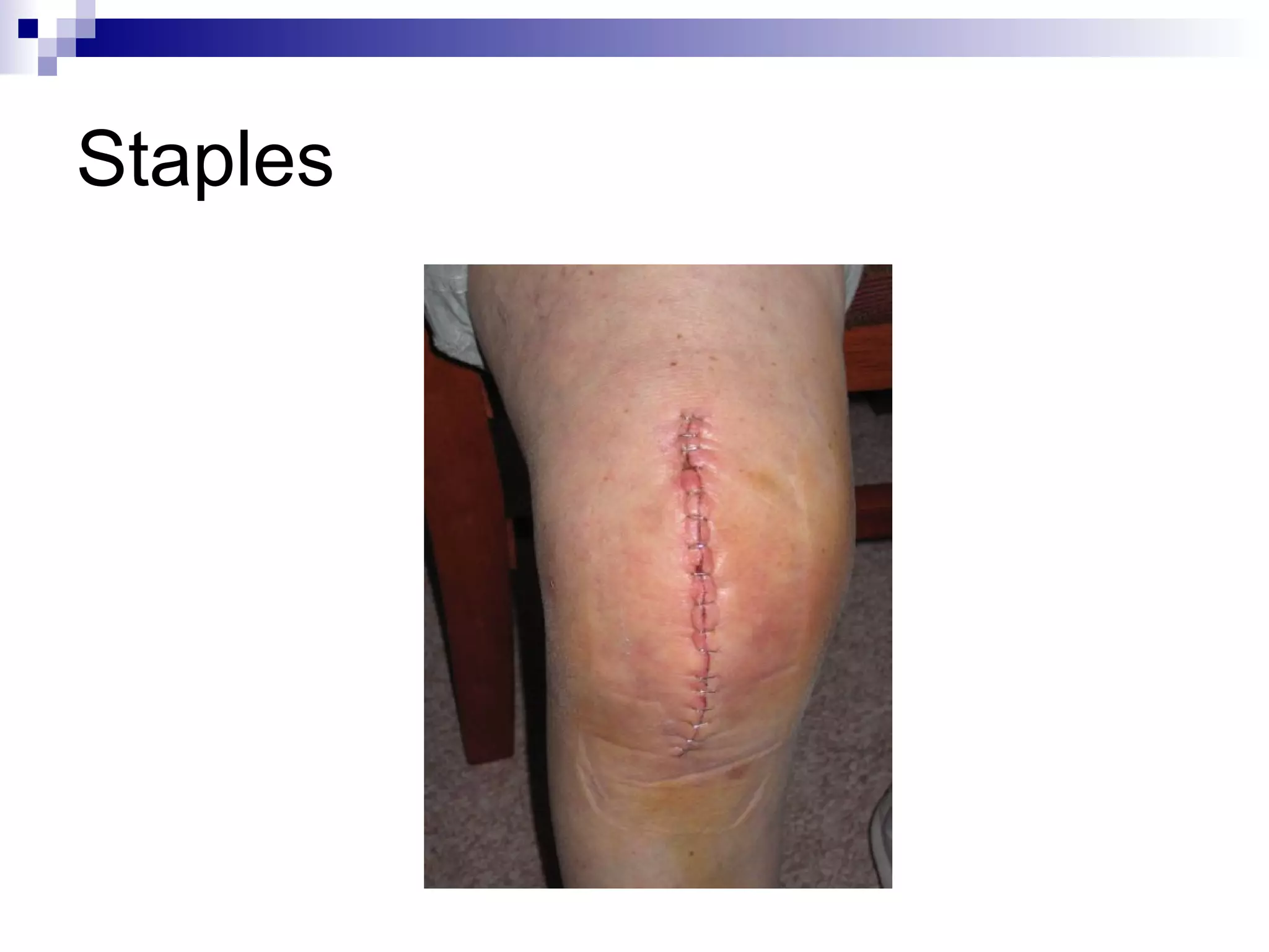 Sutures & Drainage | PPT