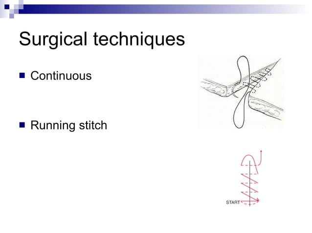 Sutures & Drainage | PPT | Surgery | Medical Health