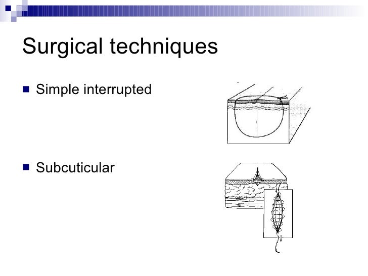 Sutures & Drainage