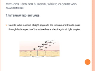 sutures and knots.pptx