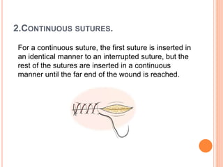 sutures and knots.pptx