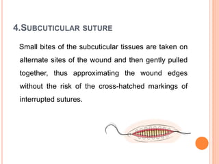 sutures and knots.pptx