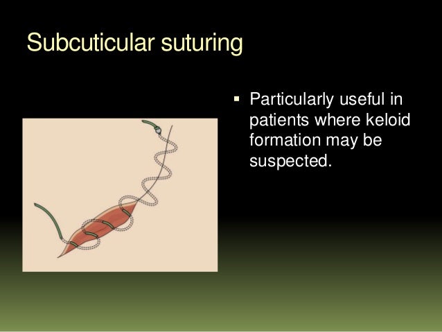Sutures and mesh