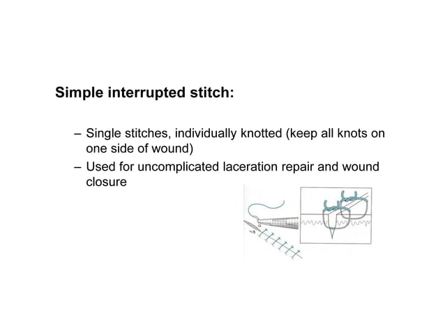 Sutures and suturing | PDF | First Aid | Injuries