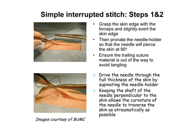 Sutures and suturing | PDF | First Aid | Injuries
