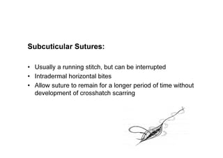 Sutures and suturing | PPT