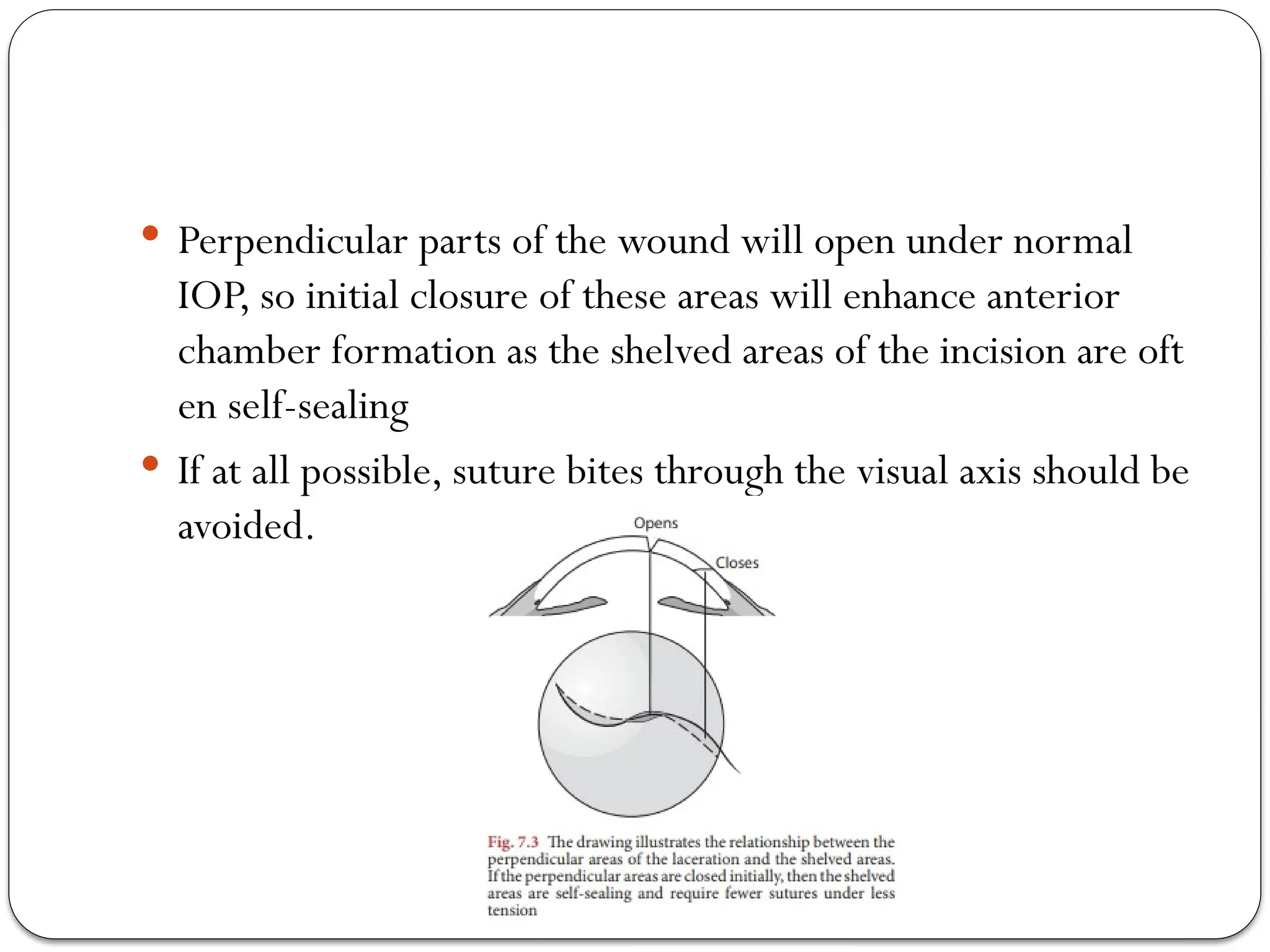 Presentation on Sutures In Ophthalmology | PPTX
