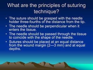 Sutures material | PPT
