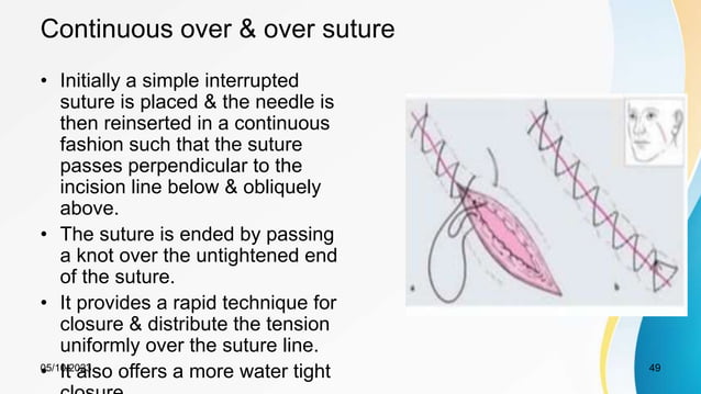 SUTURES MATERIALS & SUTURING TECHNIQUES.pptx