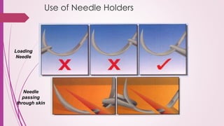 Sutures / Needles & Knots | PPTX