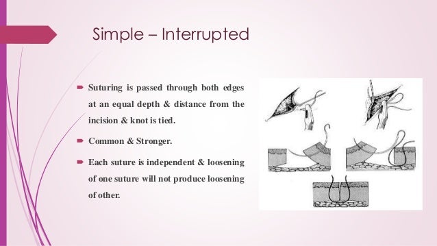 Sutures / Needles & Knots