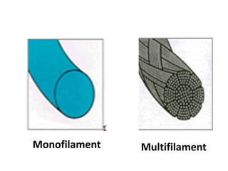 Sutures & needles in ophthalmology | PPTX
