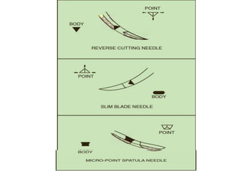 Sutures & needles in ophthalmology | PPTX
