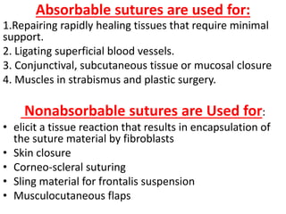 Sutures & needles in ophthalmology | PPTX