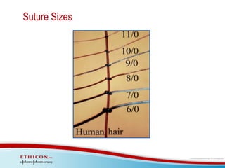 SUTURE AND NEEDLE TECHNOLOGY | PDF
