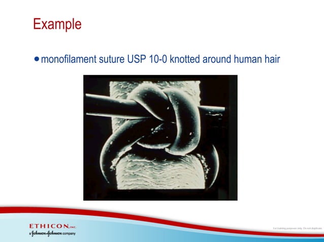 SUTURE AND NEEDLE TECHNOLOGY | PDF | Digestive Disorders | Diseases and ...