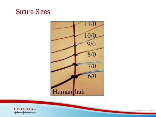 SUTURE AND NEEDLE TECHNOLOGY