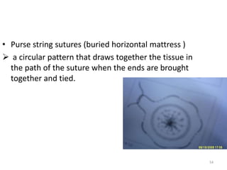SUTURE AND SUTURE MATERIALS IN SURGERY | PPTX