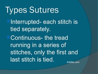 Sutures PP.ppt445456567987654356trr7ffu8765 | PPT
