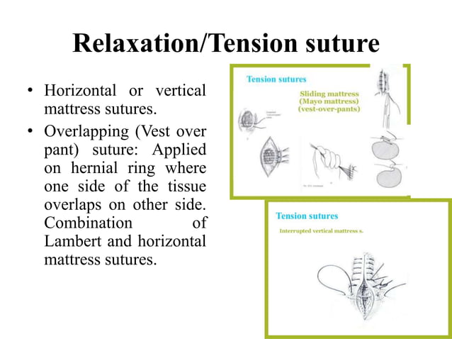 Sutures, sutures materials and suturing patterns | PPT