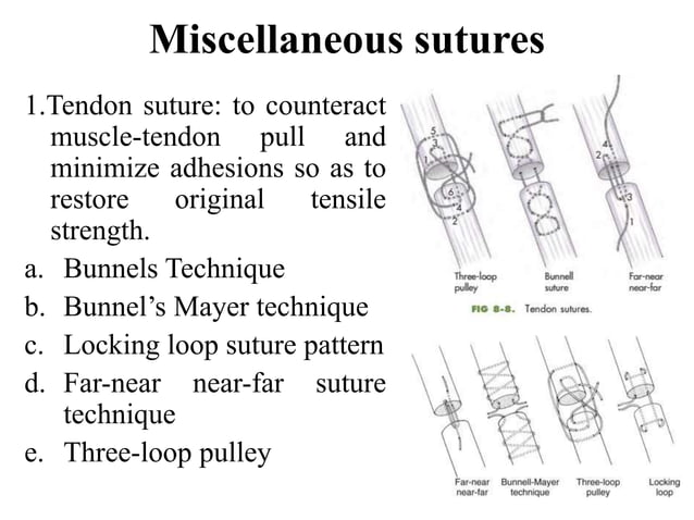 Sutures, sutures materials and suturing patterns | PPTX