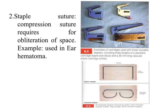 Sutures, sutures materials and suturing patterns | PPTX