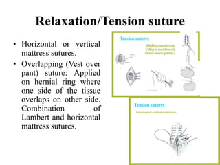 Sutures, sutures materials and suturing patterns | PPT