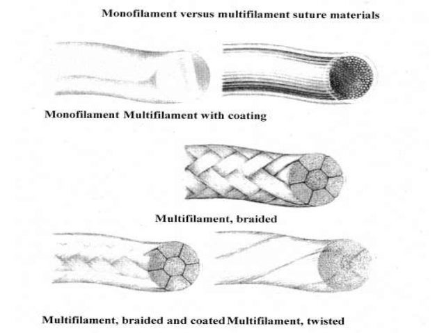 Sutures, sutures materials and suturing patterns