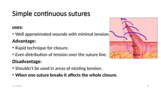 SUTURES, SUTURING TECHNIQUES AND WOUND MANAGEMENT.pptx