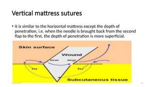 SUTURES, SUTURING TECHNIQUES AND WOUND MANAGEMENT.pptx