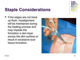 Sutures & Wound Dressings Sutures & Wound Dressings | PPT