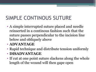 SUTURE TECHNIQUE IN OCULOPLASTIC SURGERIES | PPTX