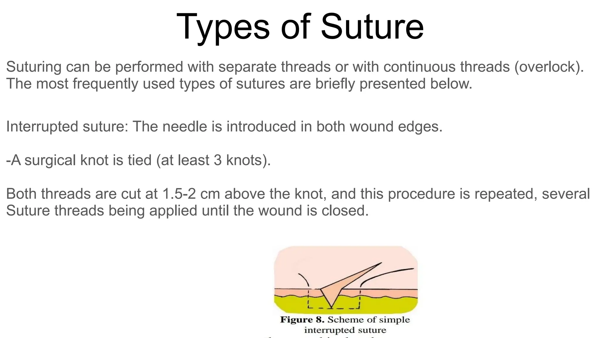 Suture techniques by souparno mandal dr jimsh | PPTX