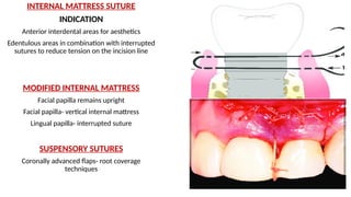 SUTURE TECHNIQUES used in dentistry . . | PPTX
