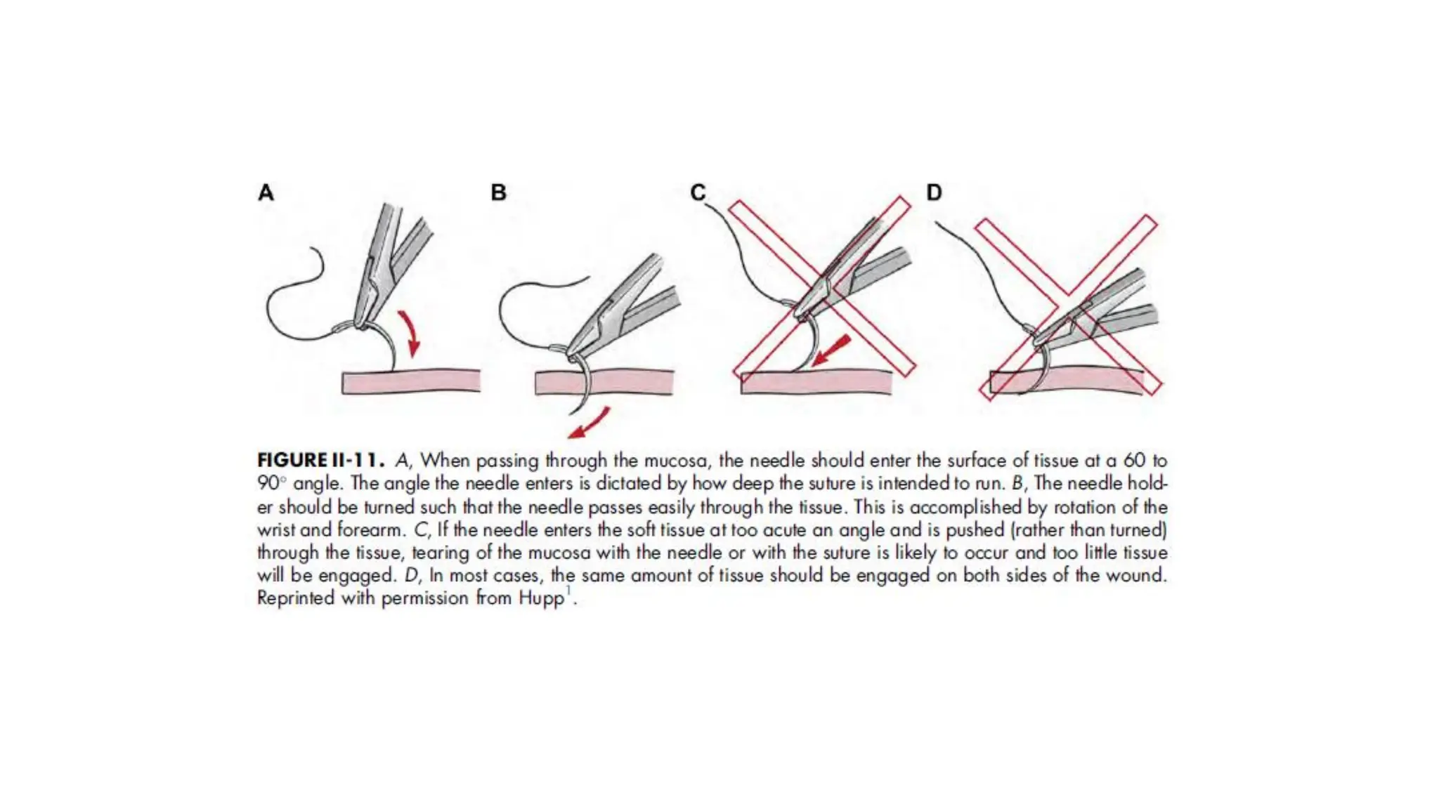 Suture techniques.pdf