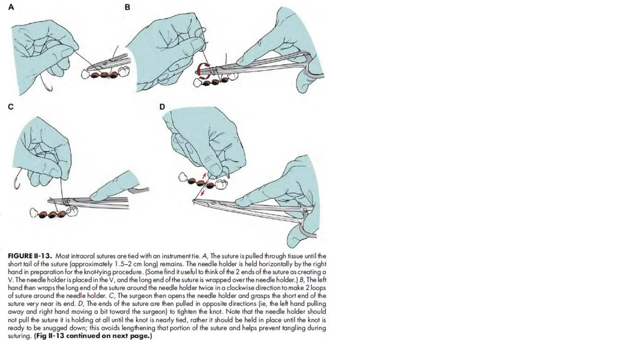 Suture techniques.pdf