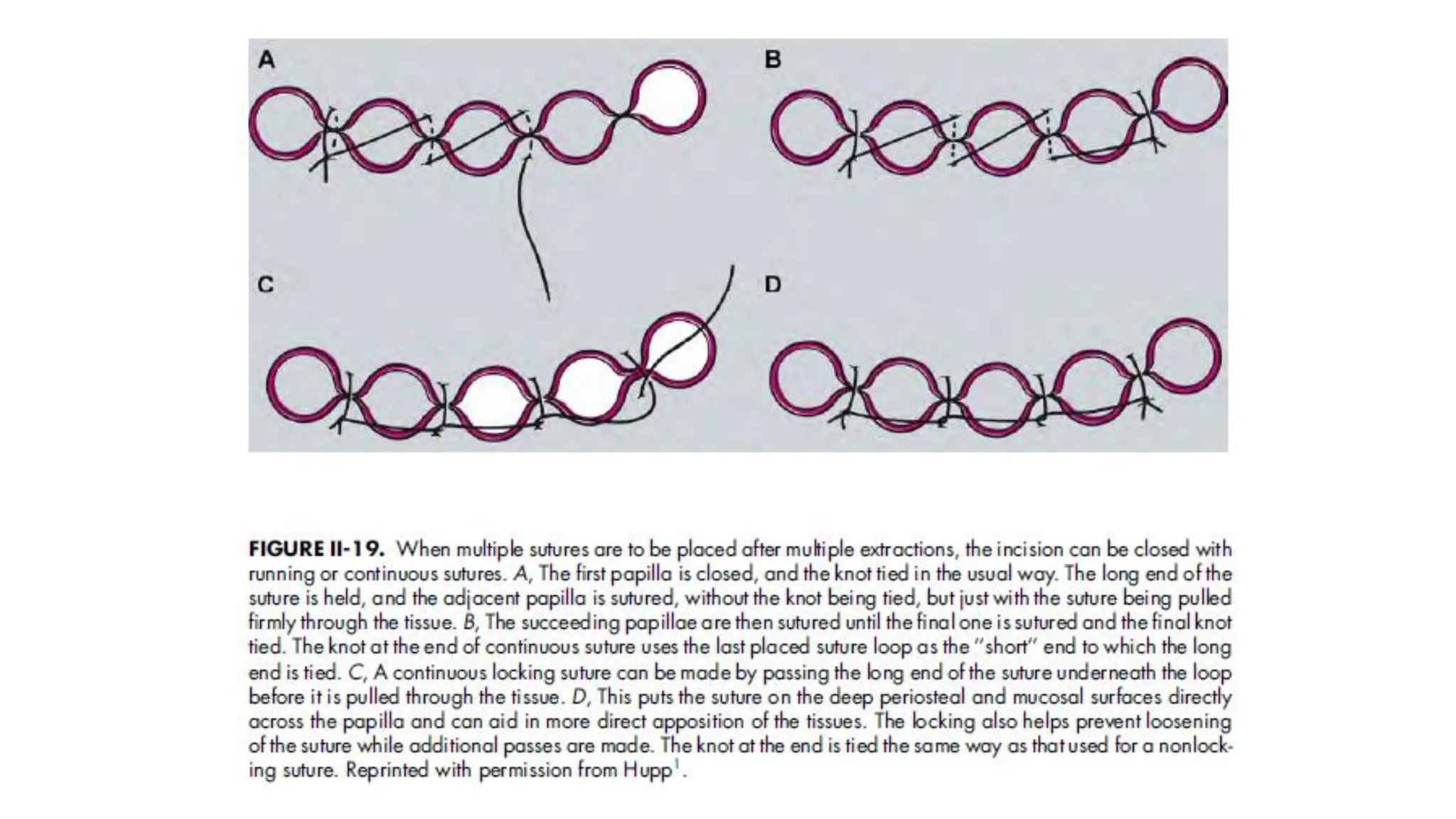 Suture techniques.pdf